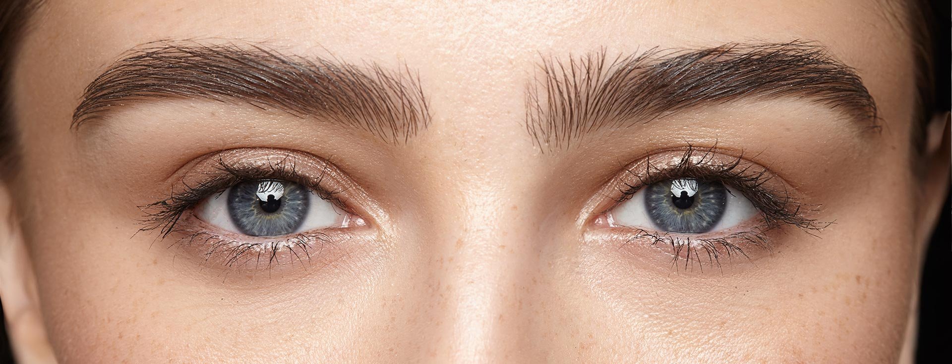 Lower Eyelid Blepharoplasty - Edmonton Eyelids